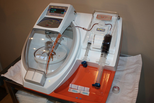 PRP-machine | Randali Centre for Aesthetic Medicine